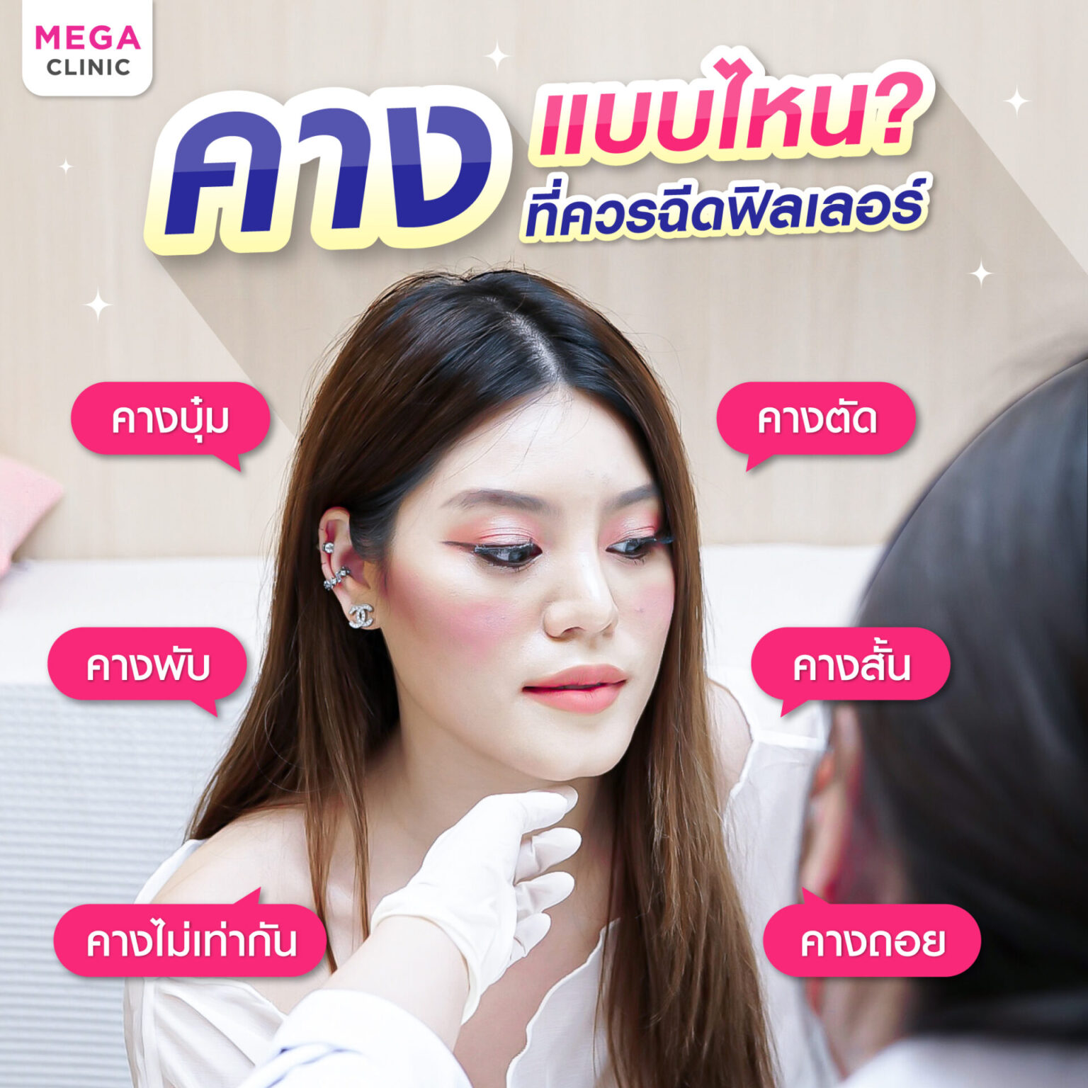 ฟิลเลอร์คาง แก้หน้ากลม ด้วยฟิลเลอร์ Neuramis | MEGA CLINIC