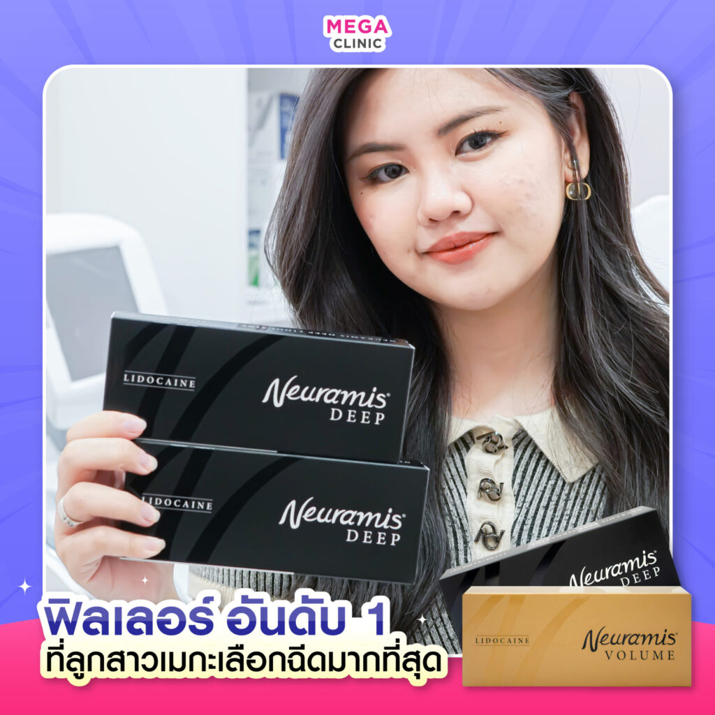 ฟิลเลอร์คาง แก้หน้ากลม ด้วยฟิลเลอร์ Neuramis | MEGA CLINIC