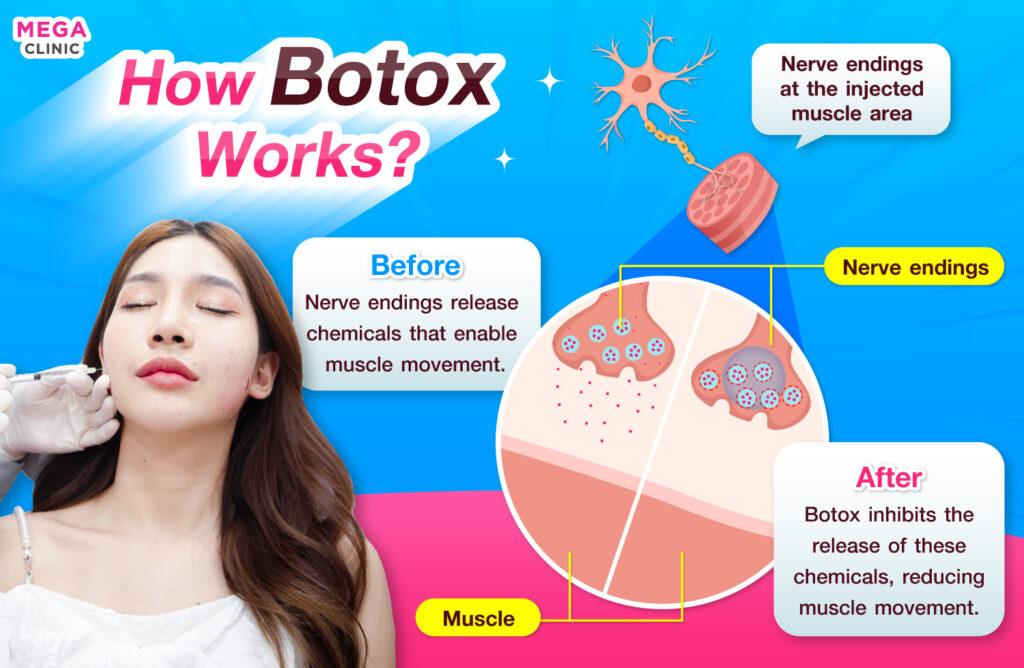 ฉีดโบท็อก กี่วันเห็นผล? คำตอบชัดที่นี่ | MEGA CLINIC