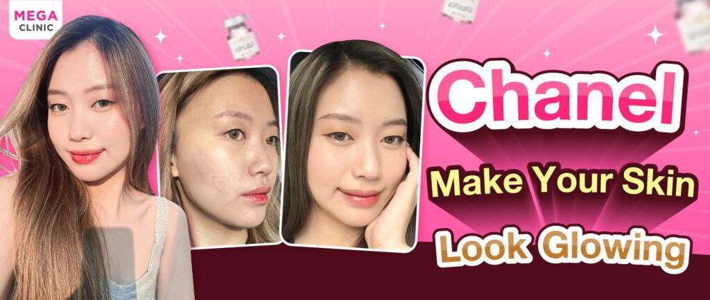 ฉีดชาแนล ผิวใส Glass Skin รีวิว ราคา เทียบกับ 2 ตัวดัง | MEGA CLINIC