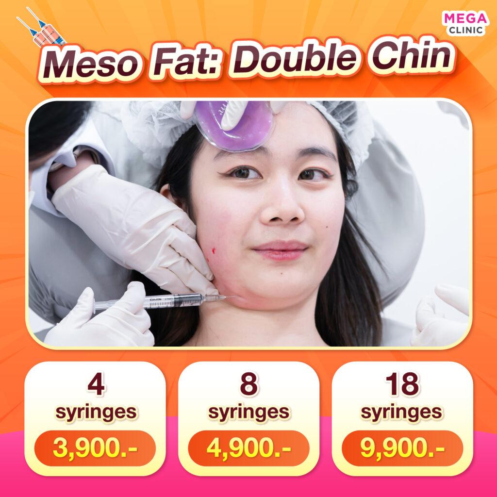 อยากลดเหนียง ต้องทำยังไง ฉีดแฟตเหนียง Lipo-S ดีไหม