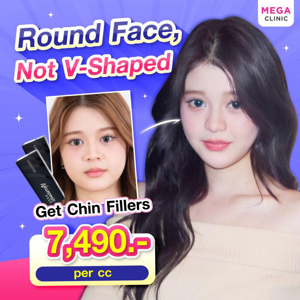 ฟิลเลอร์คาง แก้หน้ากลม ด้วยฟิลเลอร์ Neuramis | MEGA CLINIC