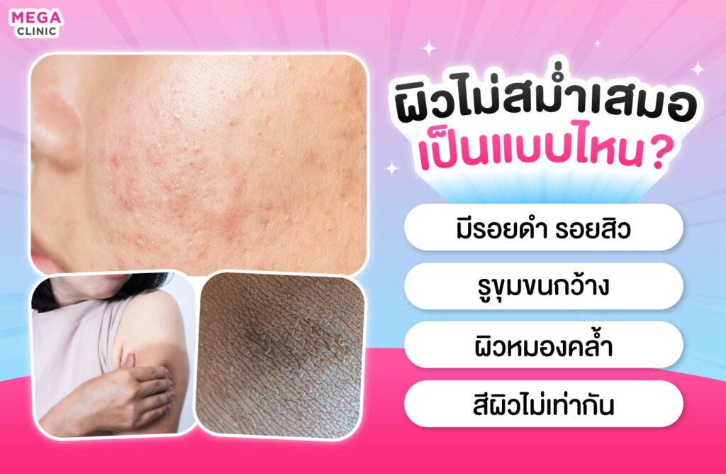 How to Fix Uneven Skin Tone Effectively