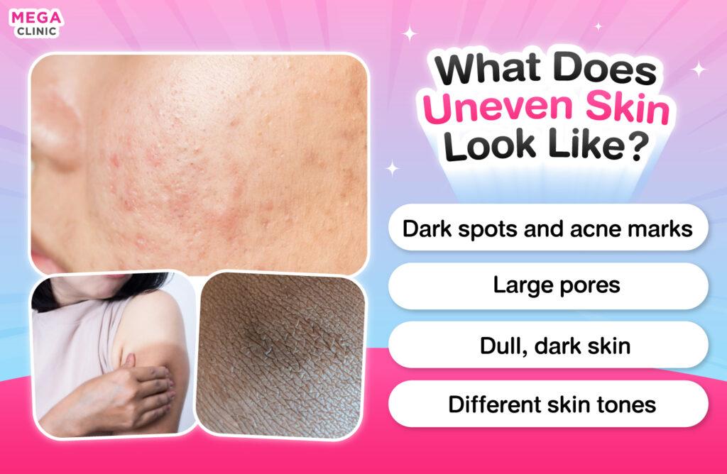 How to Fix Uneven Skin Tone Effectively