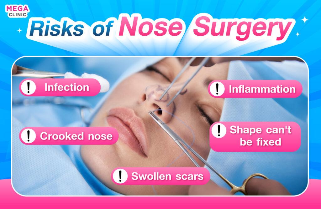 Wide Nose: Can Botox Help Create a Slimmer Shape Without Surgery?