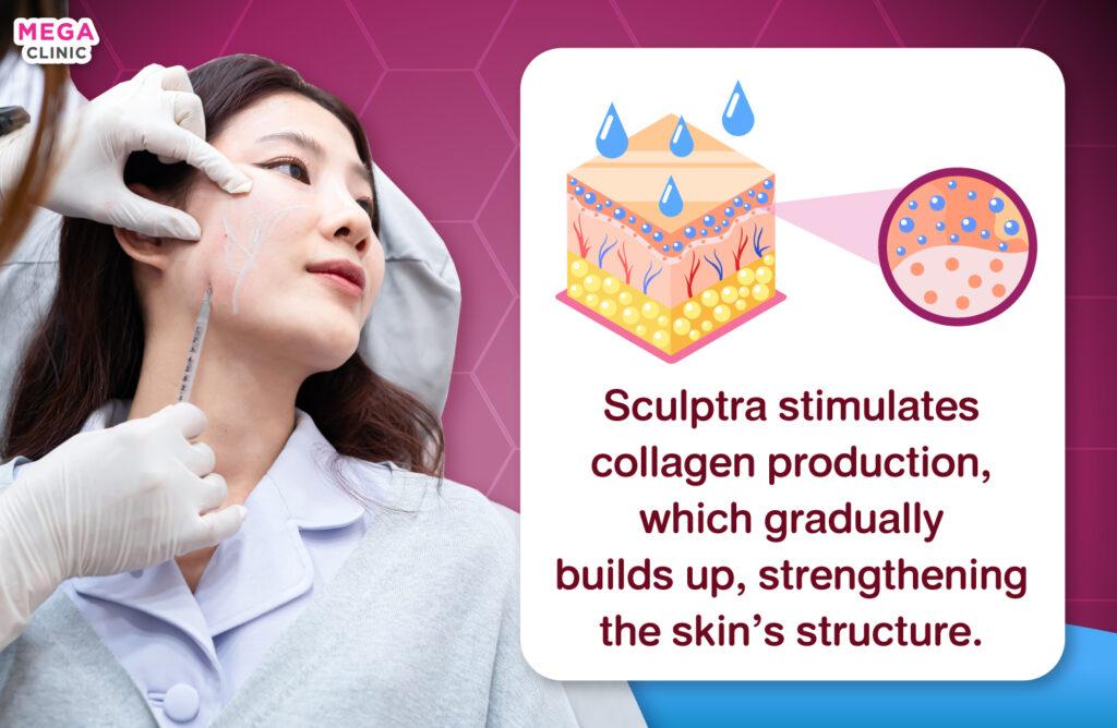 Discover Sculptra: Pros and Cons to Know Before You Decide