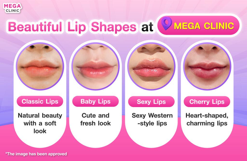 What Lip Shape Can You Get with 1 CC of Filler?