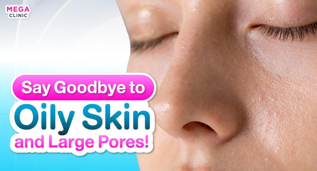 How to Fix Oily Skin and Large Pores for Smooth, Radiant Skin