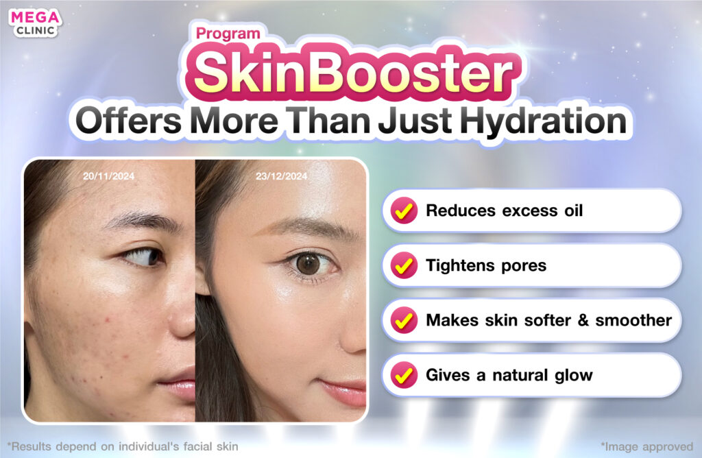What is SkinBooster? Can It Help with Dry Skin?