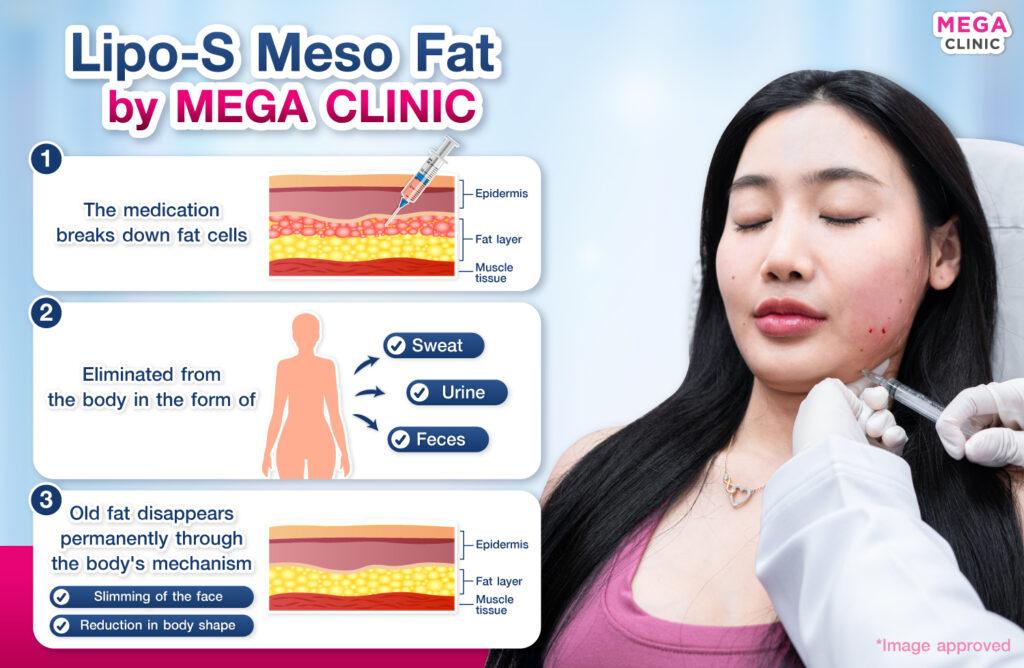 What’s the Best Way to Get Rid of a Double Chin? Face-Slimming ...